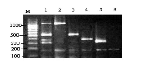 One Step Multi Pcr Detection Method For Simultaneously Detecting Four Important Citrus