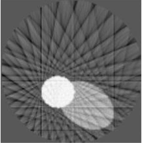 Figure 9 From Sinogram Interpolation Inspired By Single Image Super
