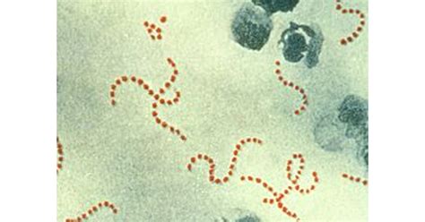 Helios Homeopathy Shop Streptococcus Pyogenes