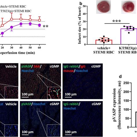 Schematic Illustration Of The Proposed Signaling In Rbcs From Patients