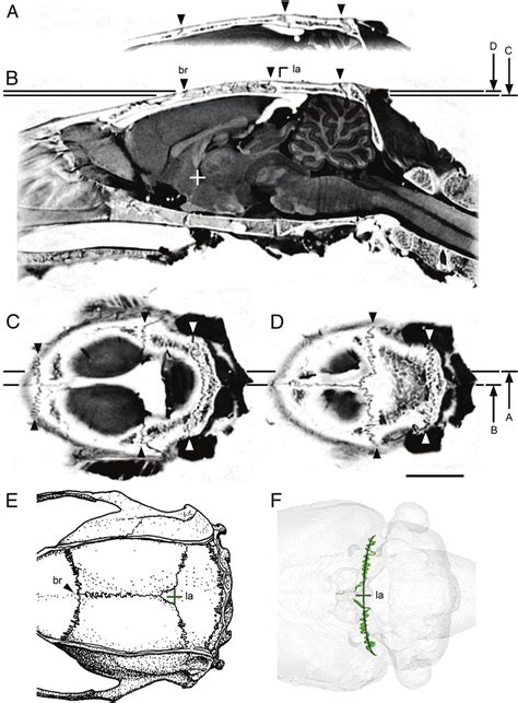 Cranial Sutures And Stereotaxic Landmarks Identified In The Waxholm