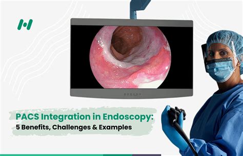 Pacs Integration In Endoscopy 5 Benefits Challenges And Examples
