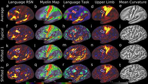 A Multi Modal Parcellation Of Human Cerebral Cortex