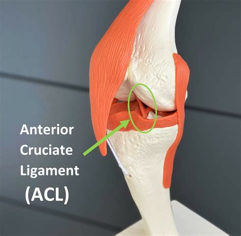 How Does The Acl Tear