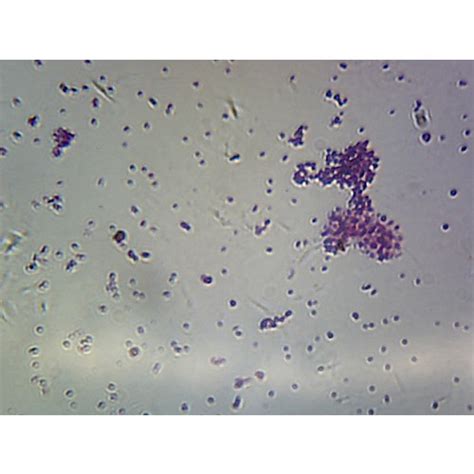 Prepared Microscope Slidediplococci Neisseria And Enterococcus Prepared Microscope Slidediplococci Neisseria And Enterococcus