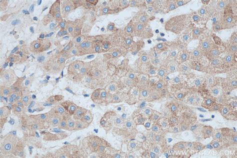 Ihceasy Cd71 Ready To Use Ihc Kit Khc0496 Proteintech 武汉三鹰生物技术有限公司