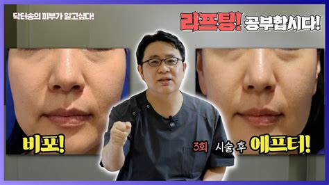 리프팅 공부해봅시다리프팅에 관한 궁금증 해결 리프팅추천 피부노화 피부관리 Youtube