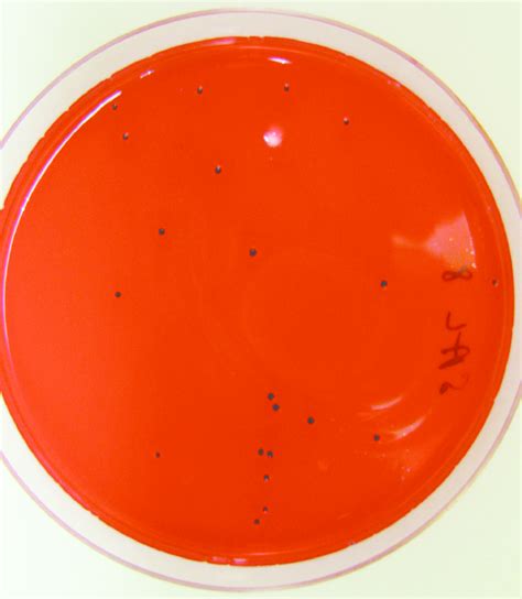 Representative Plate Showing Presumptive Positive Salmonella Spp Download Scientific Diagram