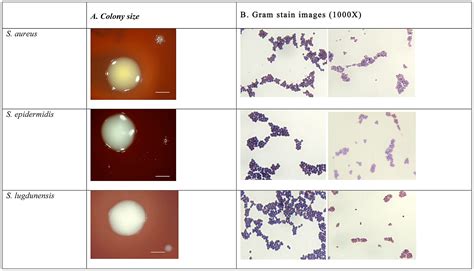 Gram Stain Staphylococcus Aureus