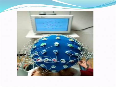 Electroencephalography Eeg Pptx