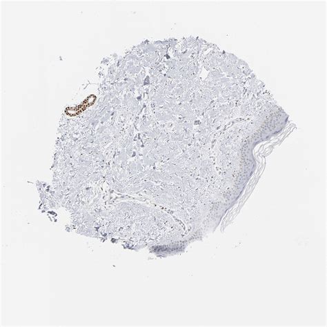 Tissue Expression Of Runx1 Staining In Skin The Human Protein Atlas