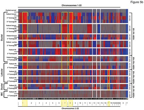 Gene Expression And Copy Number Variations Found In The Original Tumors