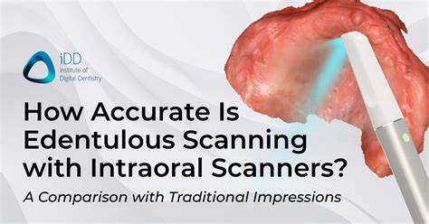 How Accurate Is Edentulous Scanning With Intraoral Scanners