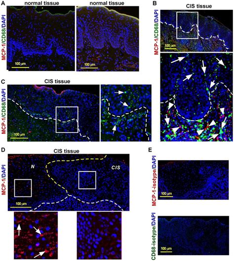 Localization Of Macrophages And Mcp 1 Expression In Normal And Cis