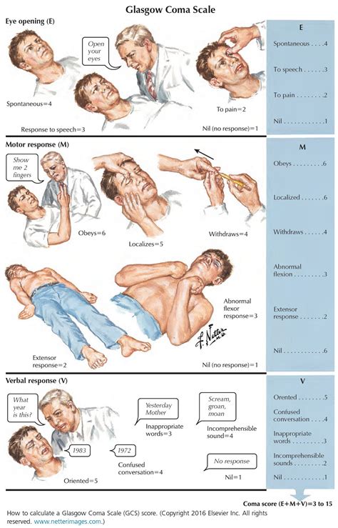 How To Calculate A Glasgow Coma Scale Manual Of Medicine