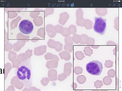 Lymphocytes Flashcards Quizlet