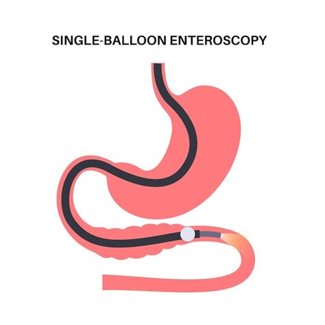 Enteroscopy Images Free Download On Freepik
