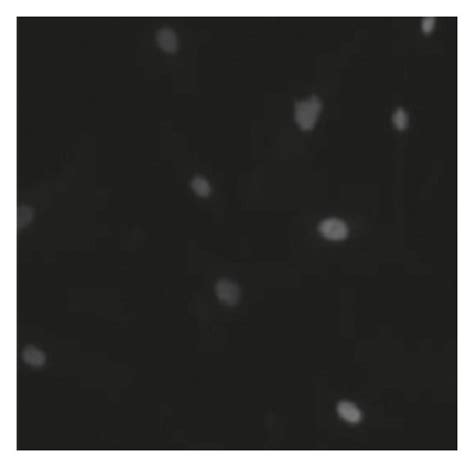Nucleus Image Segmentation Data A Original Image And B Annotated