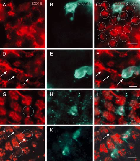 Photomicrographs Taken With The Deconvolution Microscope Of A Piece Of