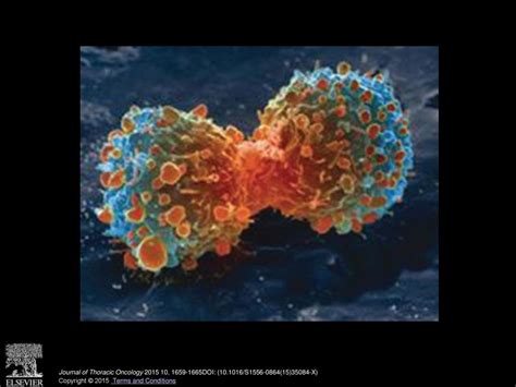 Journal Of Thoracic Oncology Ppt Download