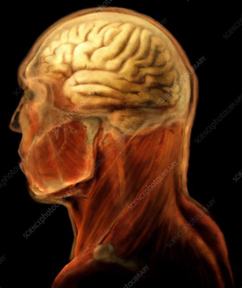 Cerebral Cortex Stock Image P330 0415 Science Photo Library
