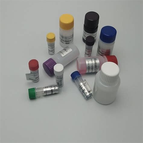 大鼠神经酰胺 Ceramide Elisa试剂盒免费代测 特异性强 产品关键词 大鼠神经酰胺elisa试剂盒