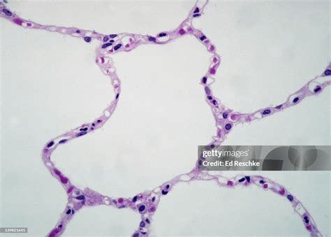 Simple Squamous Epithelium Lung Aveoli