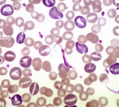 Biology Lab Practical Protist Flashcards Quizlet