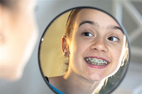Perfect Bite Elevate Confidence Dual Power Of Orthodontic Braces
