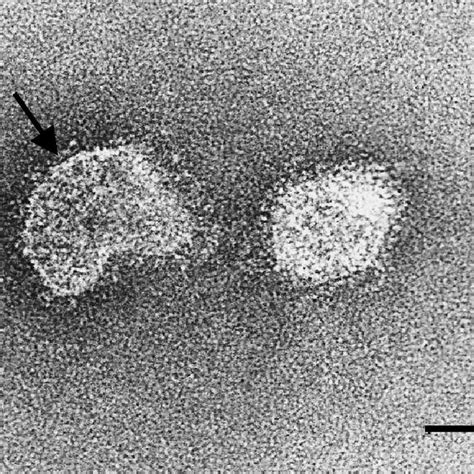Negatively Stained Paramyxovirus Particles Pleomorphic Roughly Download Scientific Diagram