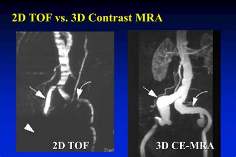 Ppt University Of Wisconsin Mri Powerpoint Presentation Free