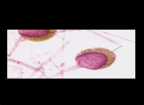 Microbiology Lab Exam 1 Flashcards Quizlet