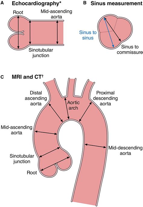 2022 Accaha Guideline For The Diagnosis And Management Of Aortic