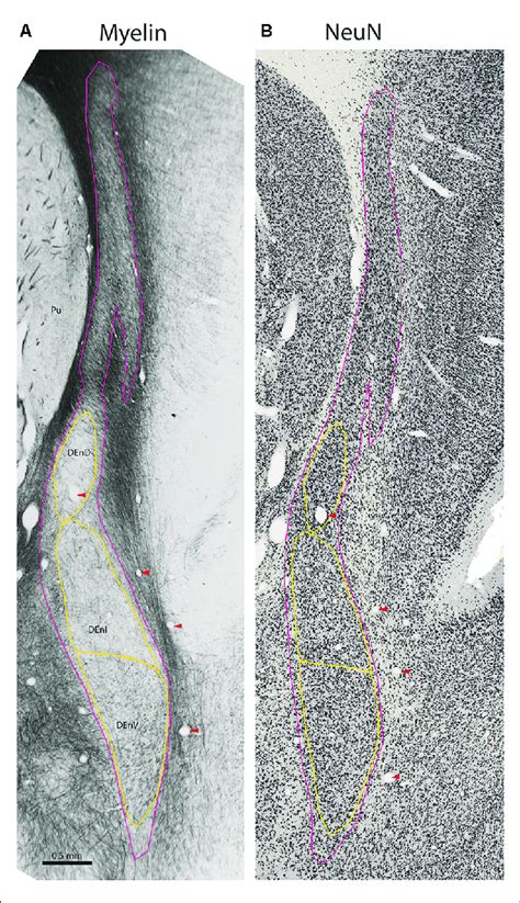 Internal Subdivisions Of The Claustrum Complex In The Marmoset