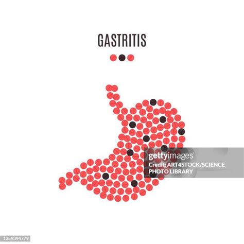 Gastritis Photos And Premium High Res Pictures Getty Images