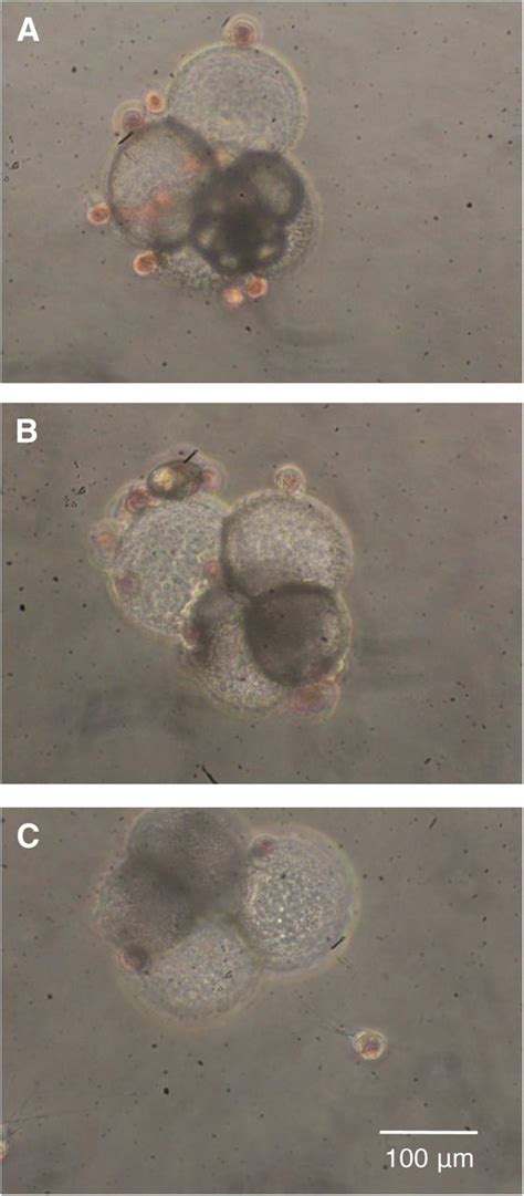 A 540 Million Year Old Microscopic Protist Sex Mystery Is Solved