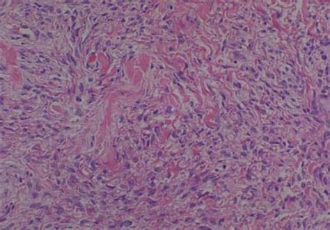 Novus Biologicals™ Human Ovary Tissue Microarray Cancer Slide Human