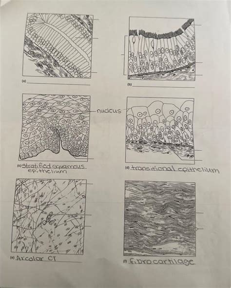 C Stratificd Squamous Epithelium D Transitional