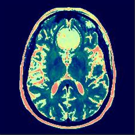 Brain Tumors Mri Crystal Clean Colorized Dataset Kaggle