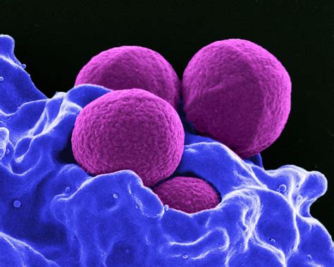 New Guidelines Recommend Antibiotic Stewardship For Preventing Mrsa Cidrap