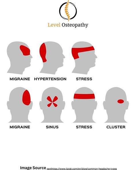 Understanding The Pain Different Types Of Headaches