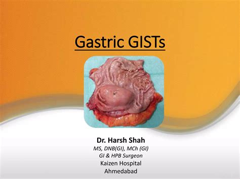 Gastric Gist By Dr Harsh Shah Ppt