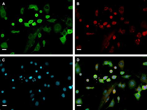 Localization Of Ssat In L56br C1 Cells Treated With 10 M M Denspm For Download Scientific