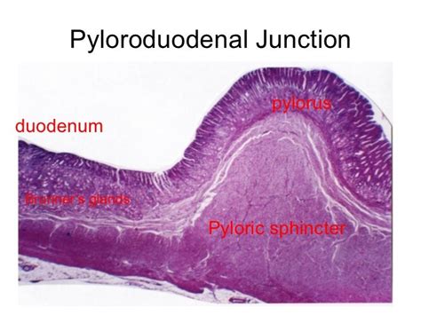 Pyloric Sphincter Histology