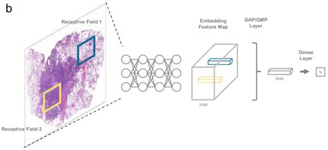 From Patches To Slides How To Train Deep Learning Models On Gigapixel Images With Weak