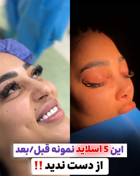 ‎دکتر مجید عمادی فوق تخصص جراحی پلاستیک‎ Dremadi • Instagram