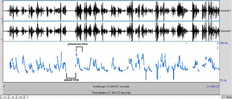 Sample Waveform And Pitch Contours Of Oral Text Reading Computed In