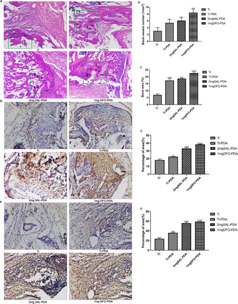 Improvement Of Polydopamine Loaded Salidroside On Osseointegration Of Titanium Implants Pmc
