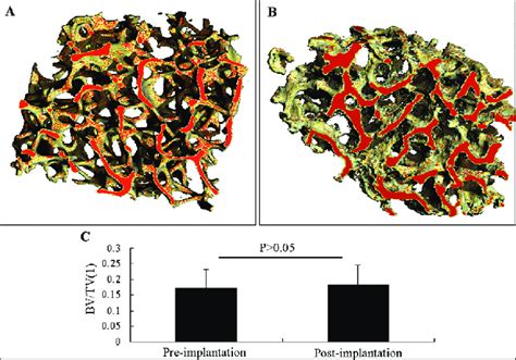 Three Dimensional Micro Ct Analysis New Bone Formation Was Monitored