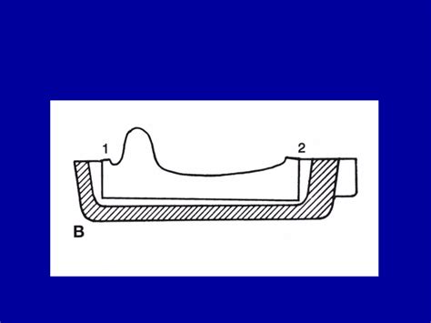 Plete Denture Wax‐up And Flasking Procedure Ppt